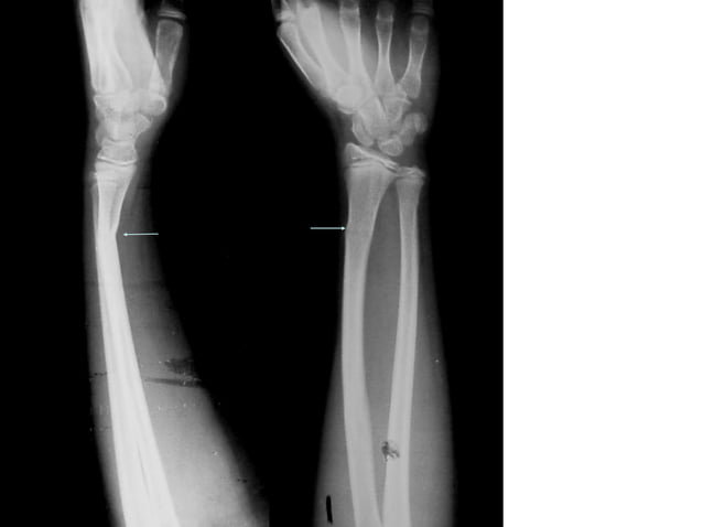 Msk Test2 1st Hospital | PPT