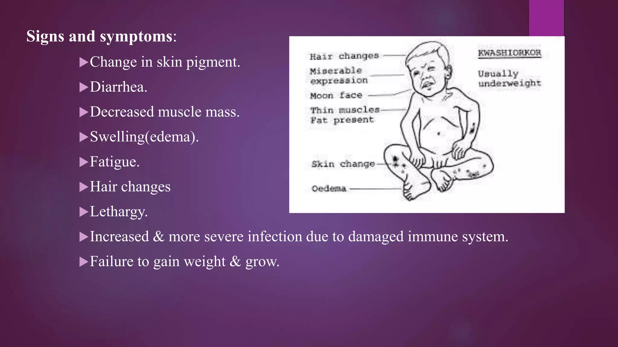 BALANCED DIET & TREATMENT & PREVENTION OF DEFICIENCY DISORDERS | PPTX