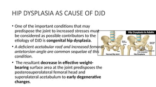 MSK Disorders Musculoskeletal disorder explained | PPTX