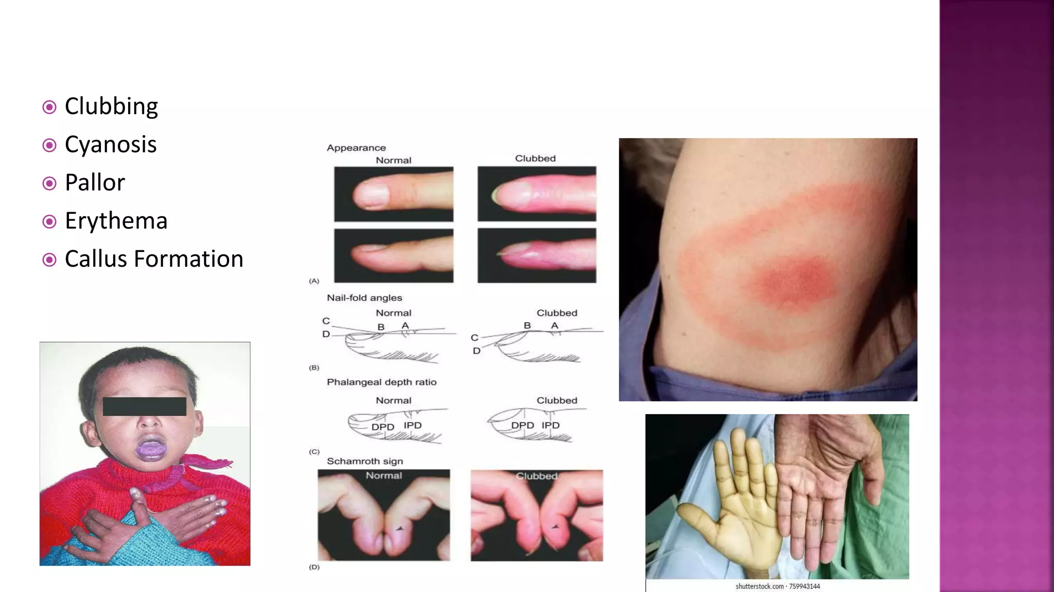 MSK Examination.pptx