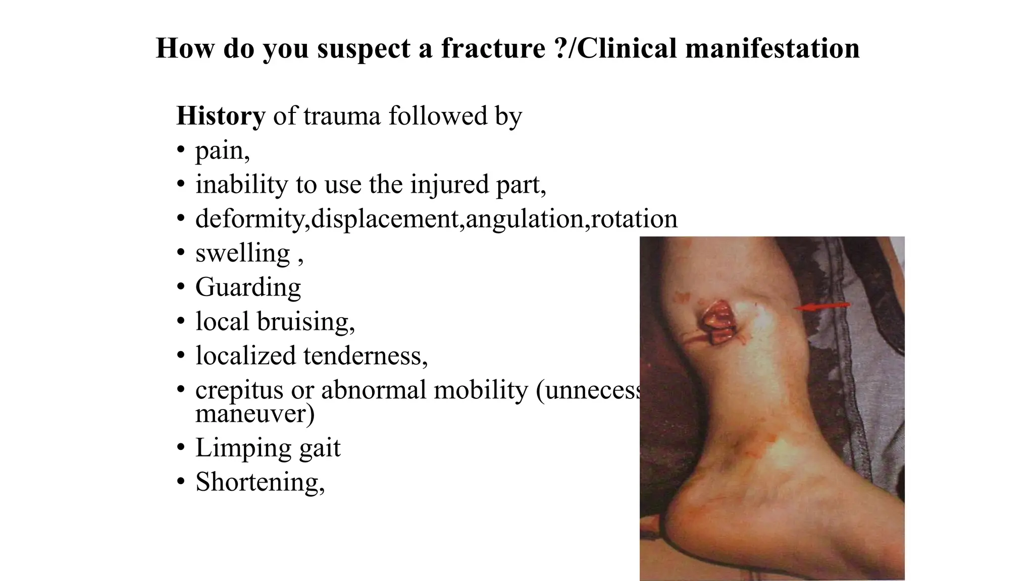 MSK INJURY Bsc,Nurse_121638.ppt for nurses | PPTX