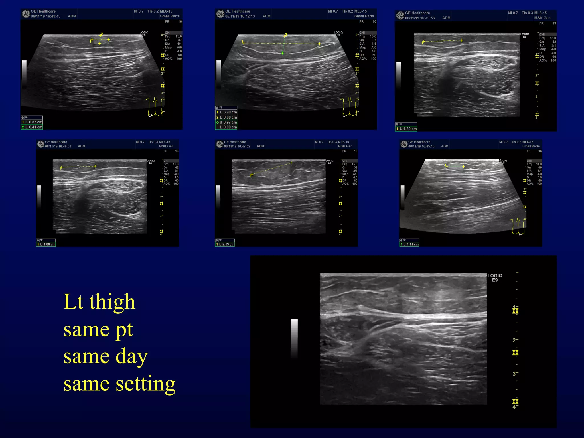 Msk need to know ultrasound lumps & bumps & various joints | PDF
