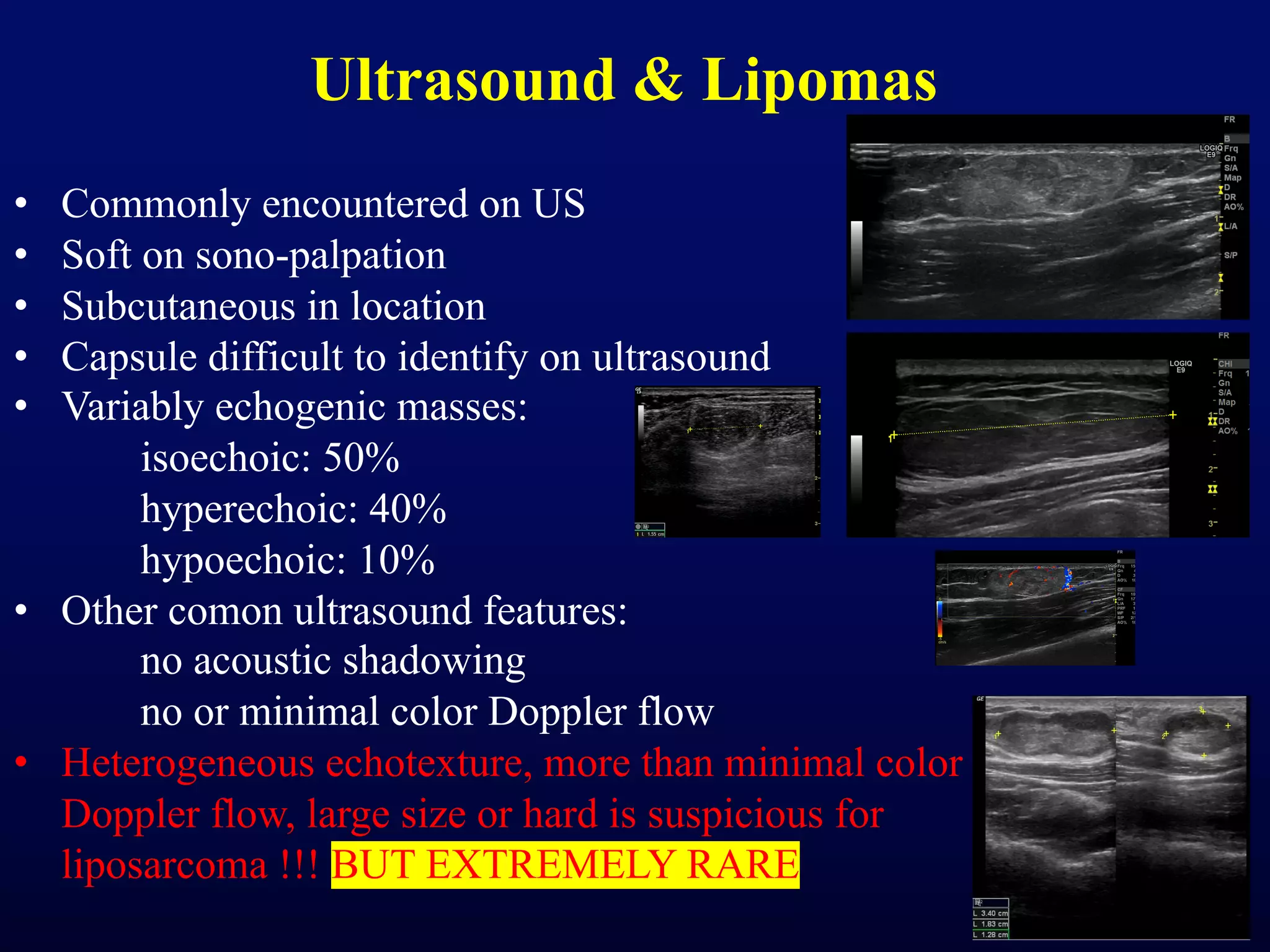 Msk need to know ultrasound lumps & bumps & various joints | PDF