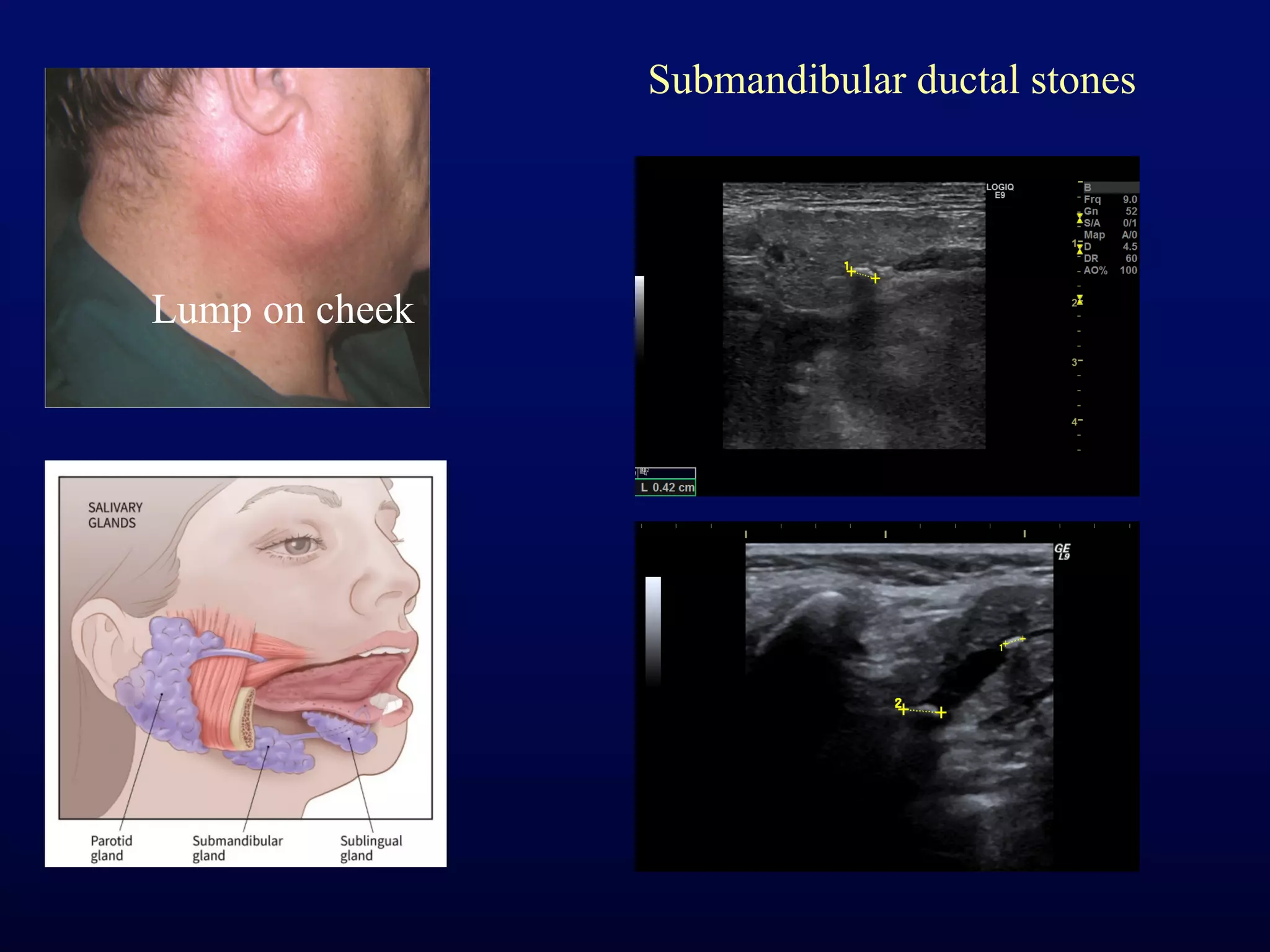 Msk need to know ultrasound lumps & bumps & various joints | PDF