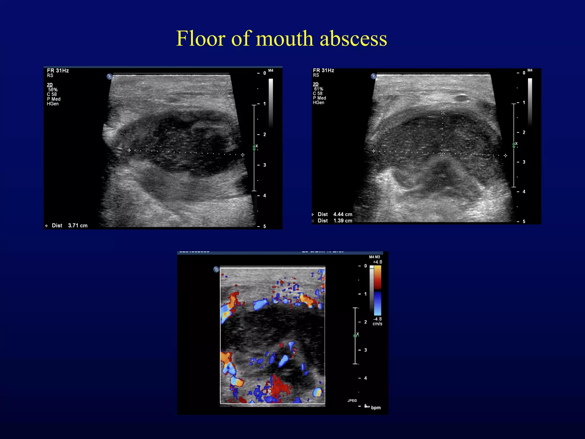 Msk need to know ultrasound lumps & bumps & various joints | PDF