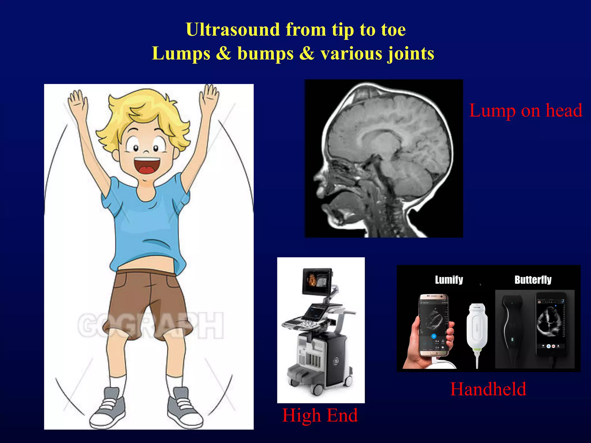 Msk need to know ultrasound lumps & bumps & various joints | PDF