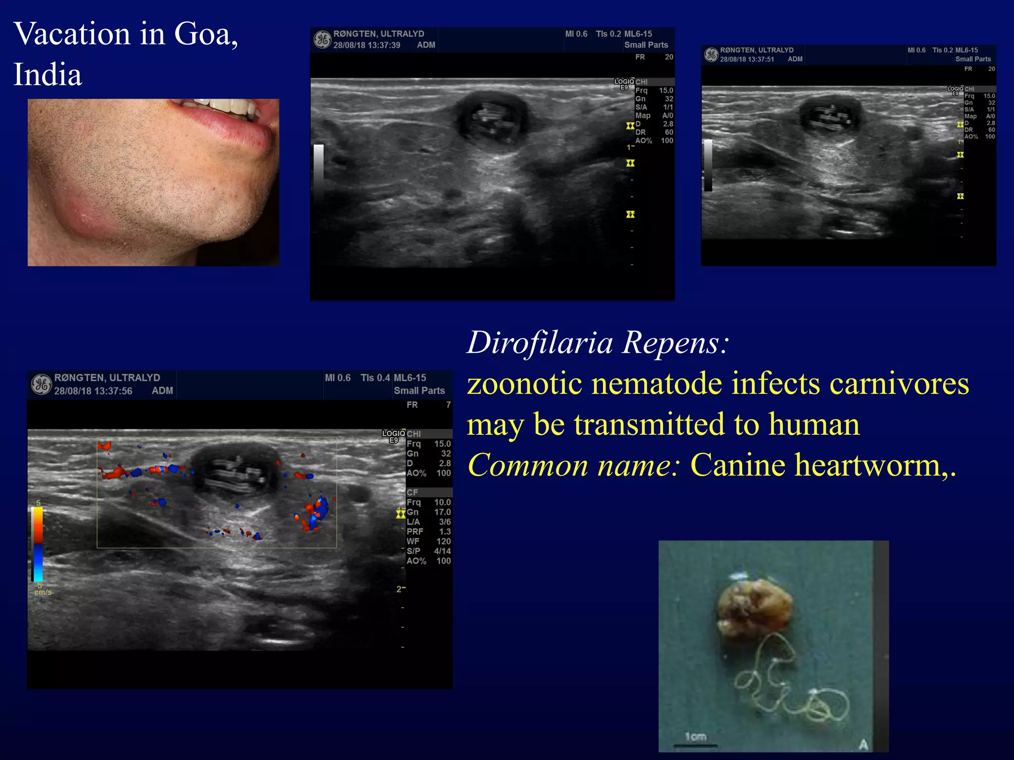 Msk need to know ultrasound lumps & bumps & various joints | PDF