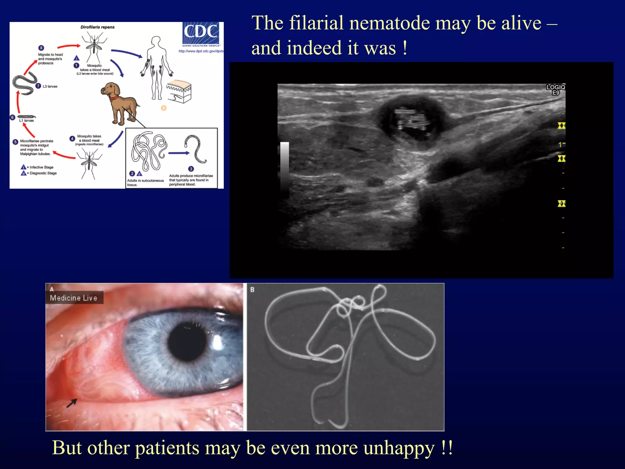 Msk need to know ultrasound lumps & bumps & various joints | PDF