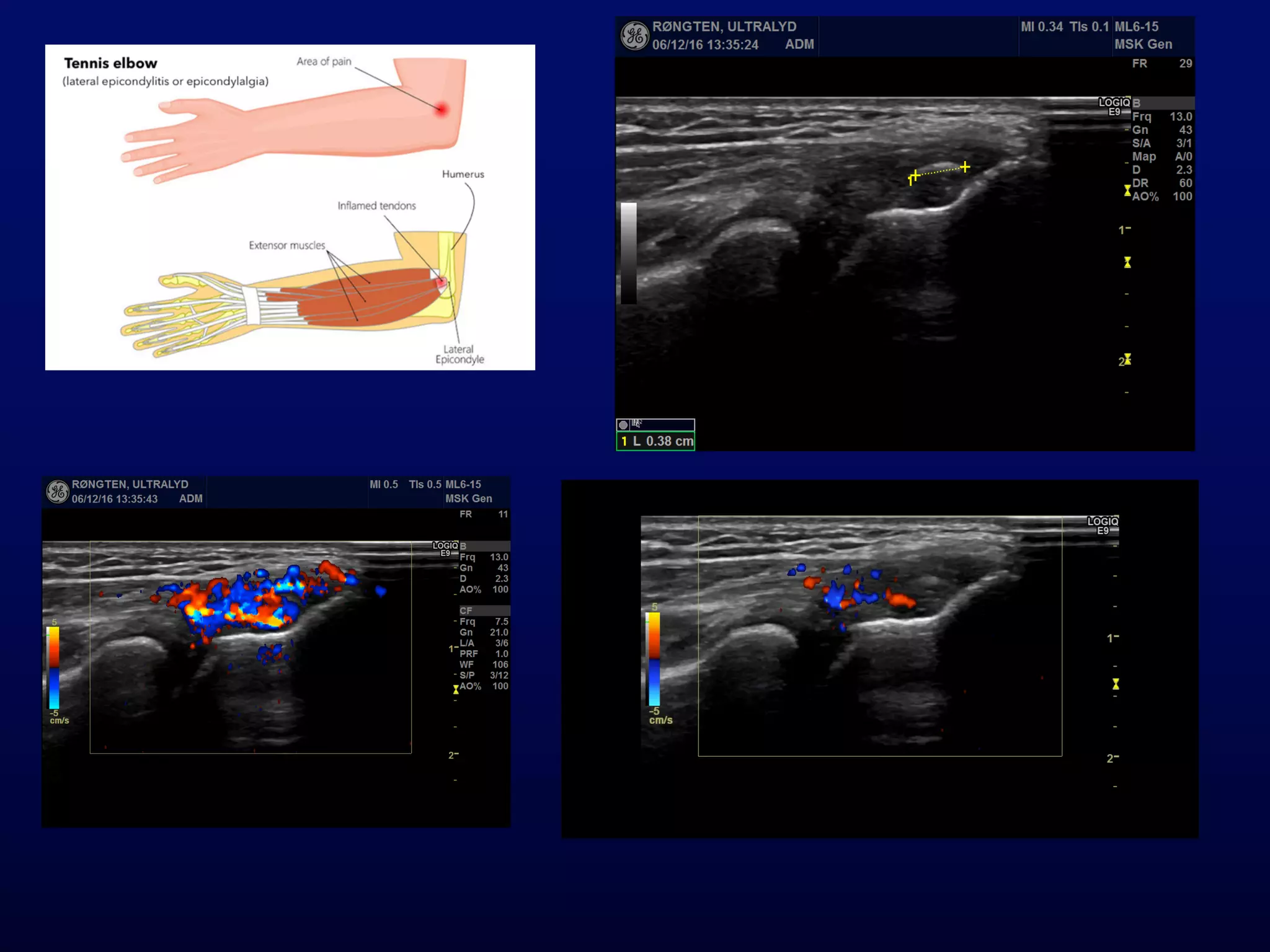 Msk need to know ultrasound lumps & bumps & various joints | PDF