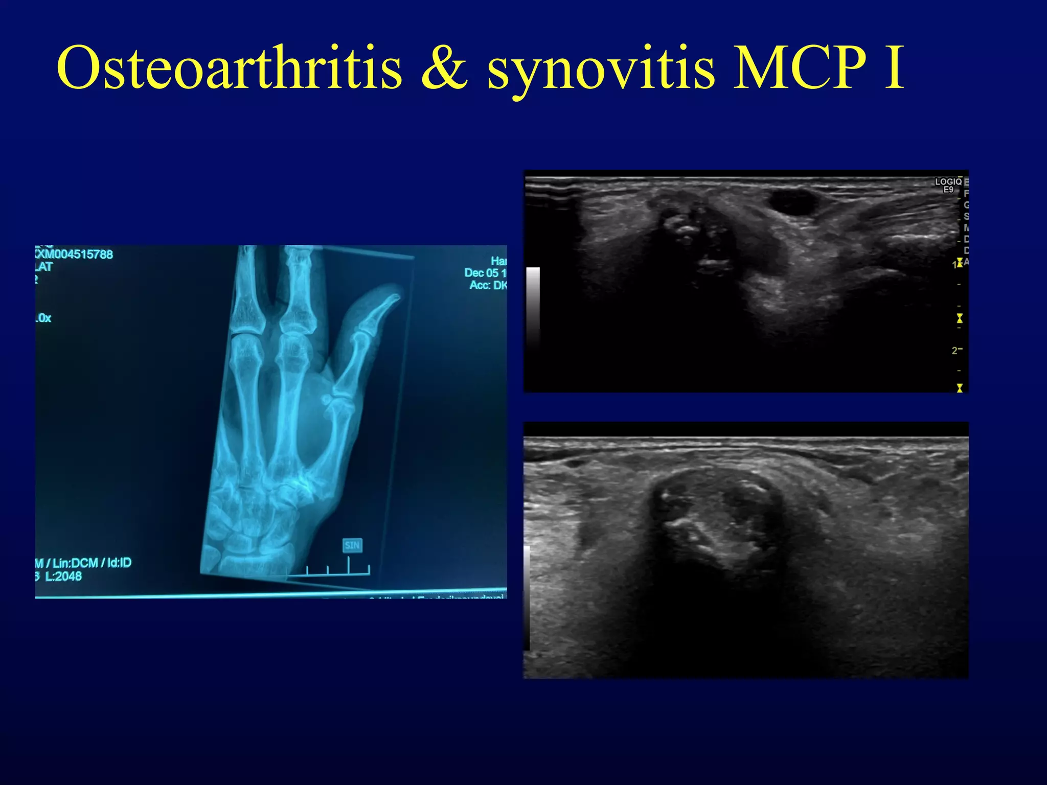 Msk need to know ultrasound lumps & bumps & various joints | PDF