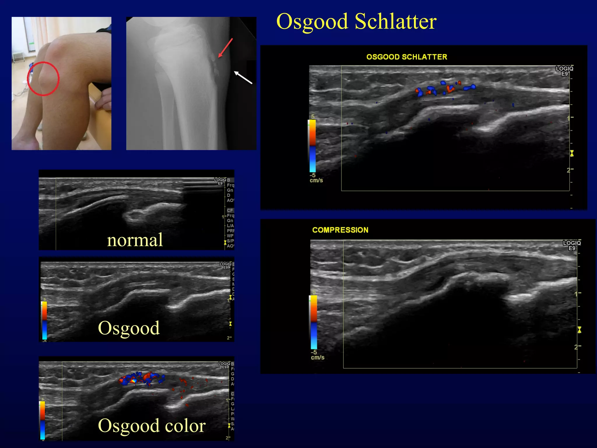 Msk Need To Know Ultrasound Lumps Bumps Various Joints Pdf