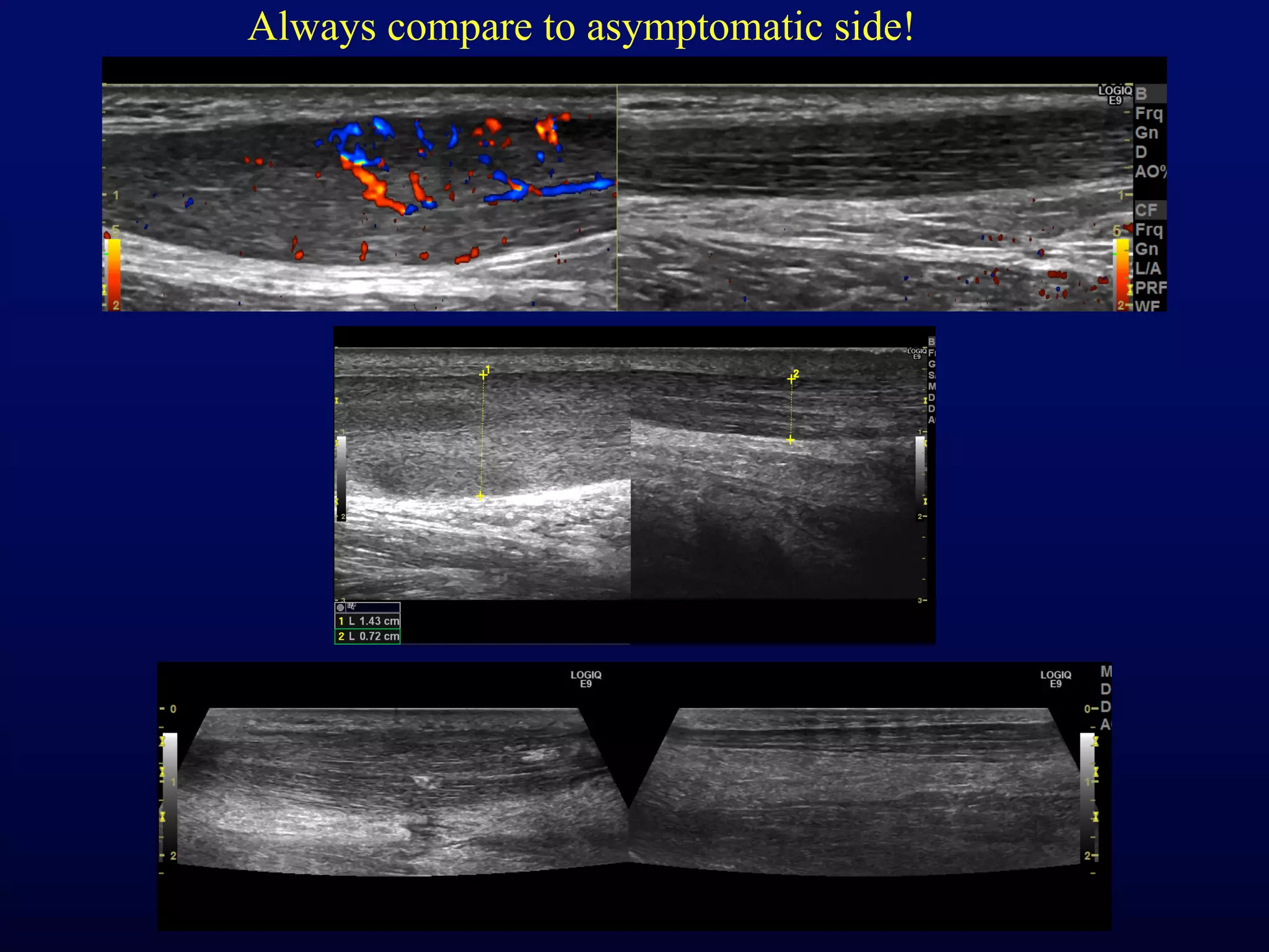 Msk need to know ultrasound lumps & bumps & various joints | PDF