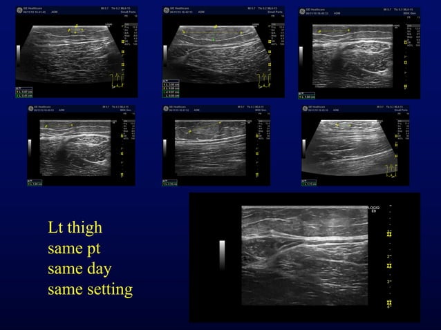 Msk need to know ultrasound lumps & bumps & various joints | PPT