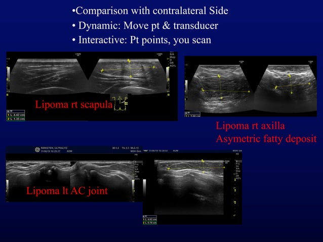 Msk need to know ultrasound lumps & bumps & various joints | PPT