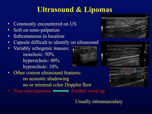 Msk need to know ultrasound lumps & bumps & various joints | PPT
