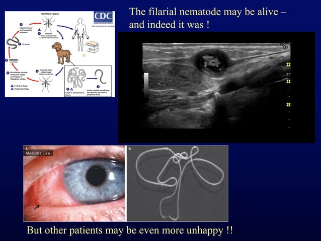 Msk need to know ultrasound lumps & bumps & various joints | PPT