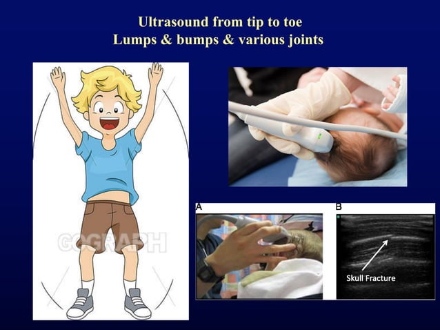 Msk need to know ultrasound lumps & bumps & various joints | PPT