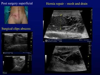 Msk need to know ultrasound lumps & bumps & various joints | PDF