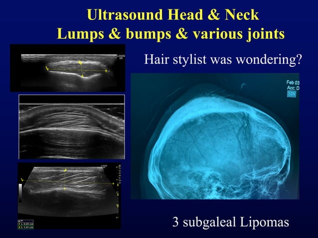 Msk need to know ultrasound lumps & bumps & various joints | PPT