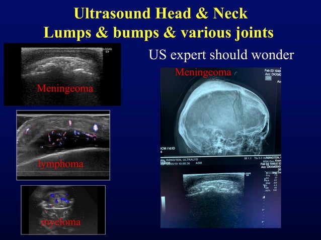 Msk need to know ultrasound lumps & bumps & various joints | PPT