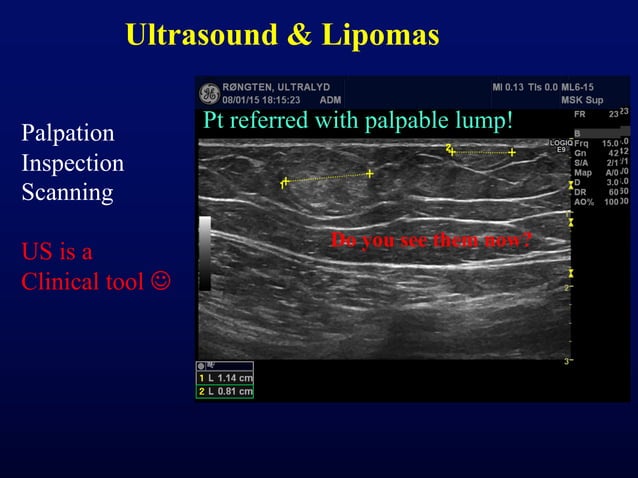 Msk need to know ultrasound lumps & bumps & various joints | PPT