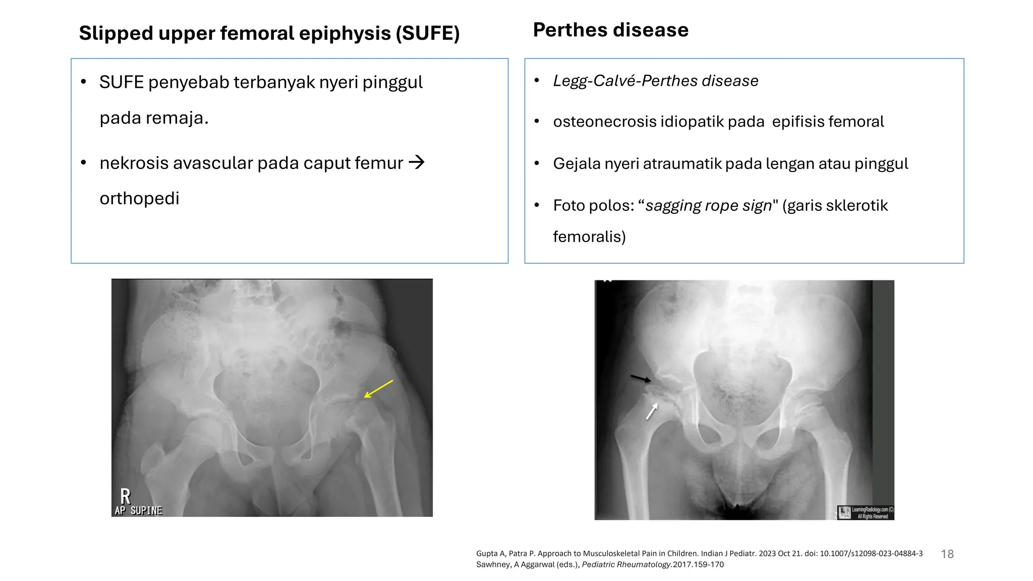 Approach to musculoskeletal pain in children.pdf