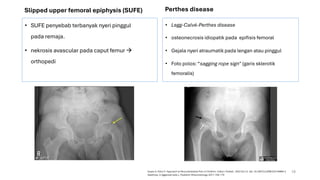 Approach to musculoskeletal pain in children.pdf