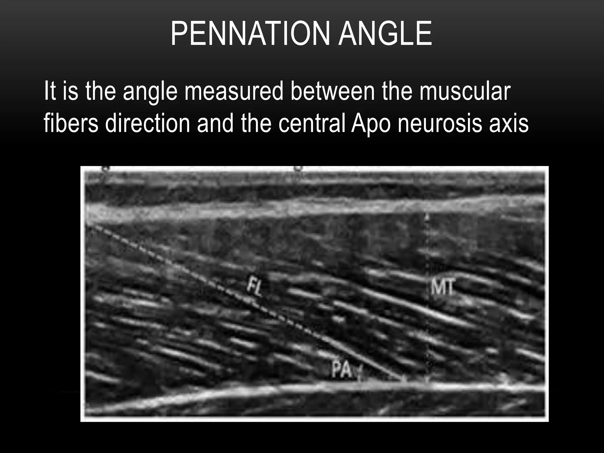 Musculoskeletal Ultrasound - Basic | PPTX
