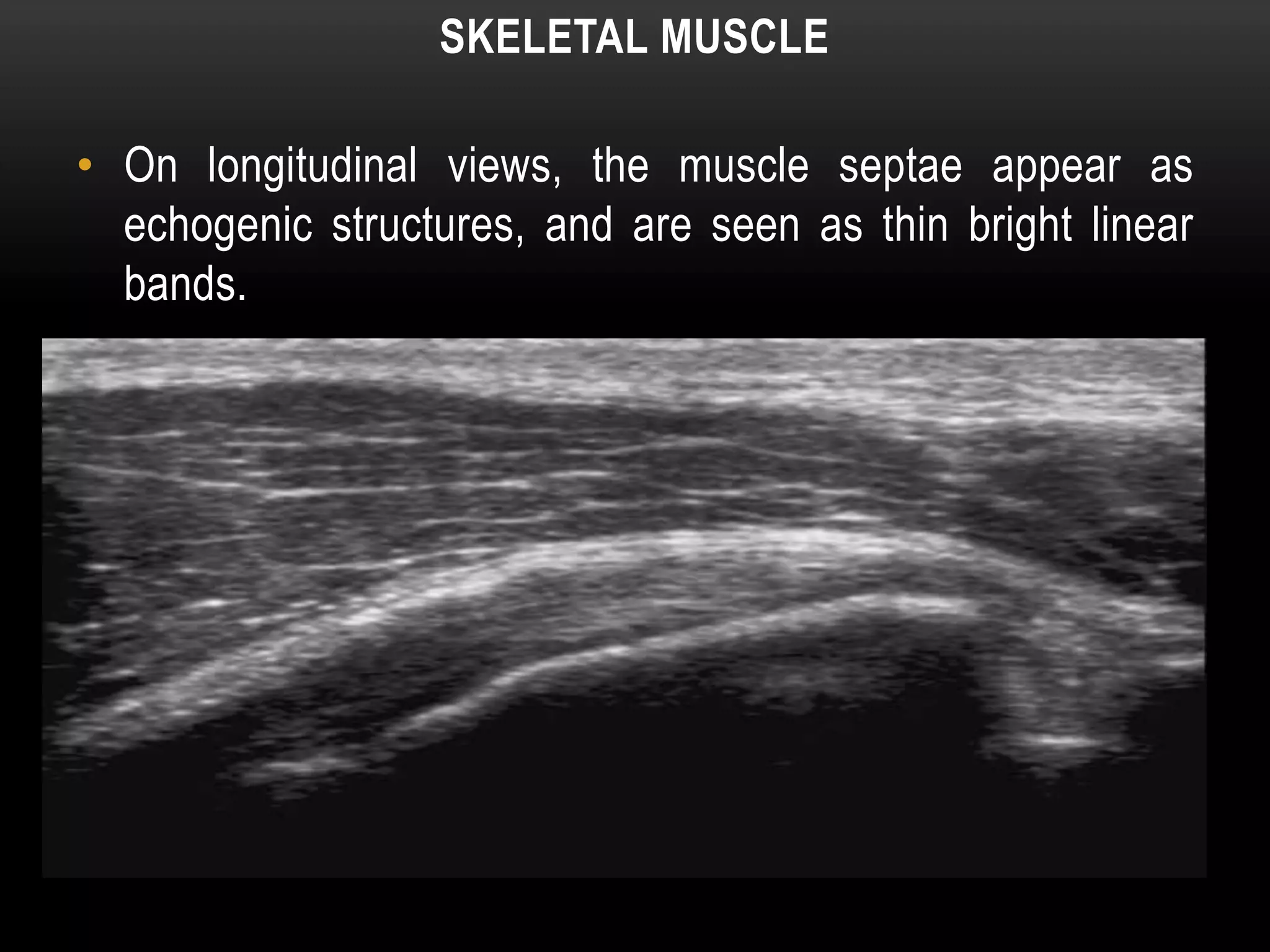Musculoskeletal Ultrasound - Basic | PPTX