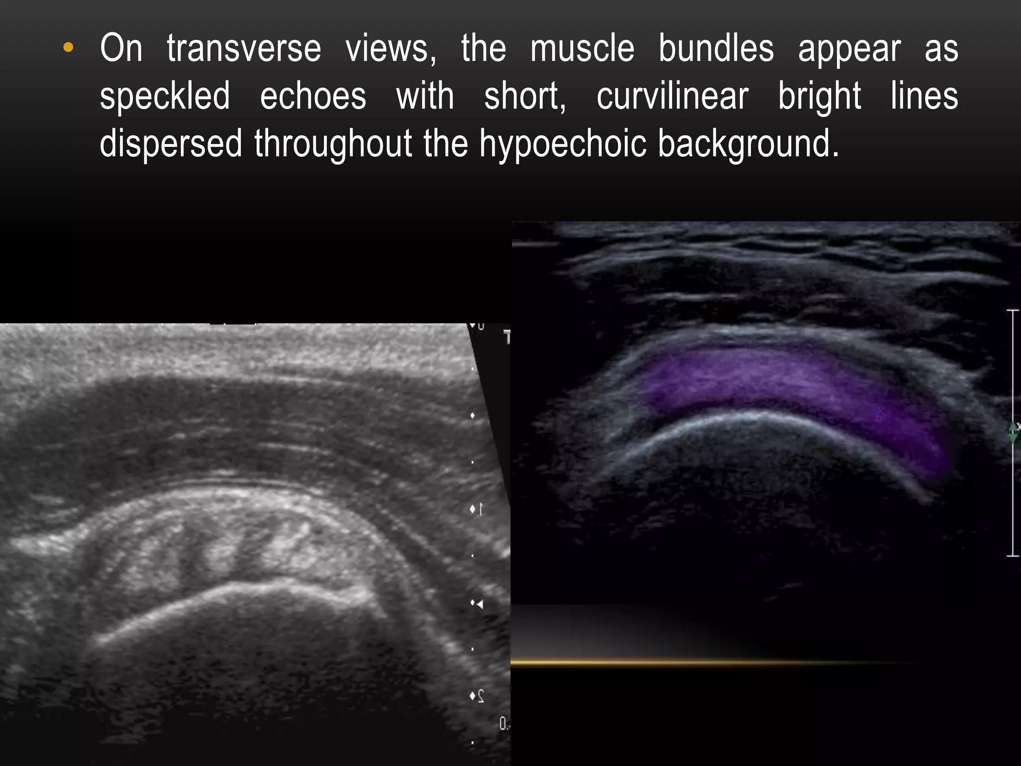 Musculoskeletal Ultrasound - Basic | PPTX