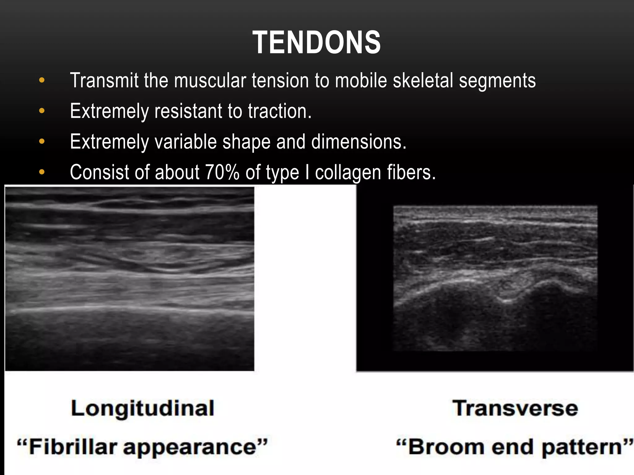 Musculoskeletal Ultrasound - Basic | PPTX