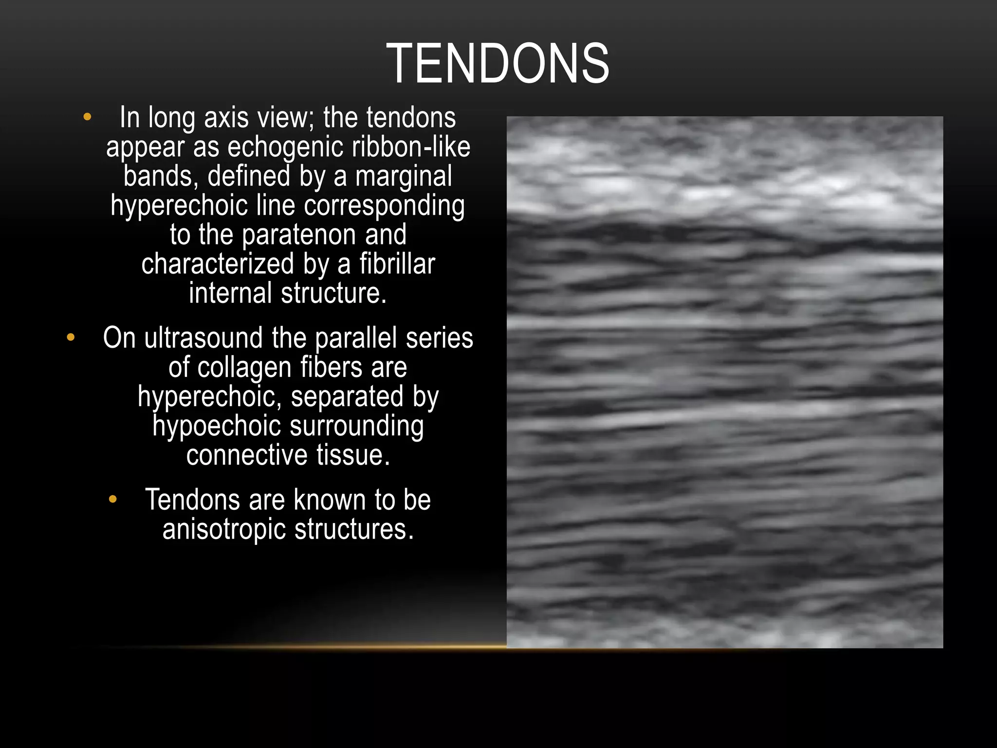 Musculoskeletal Ultrasound - Basic | PPTX
