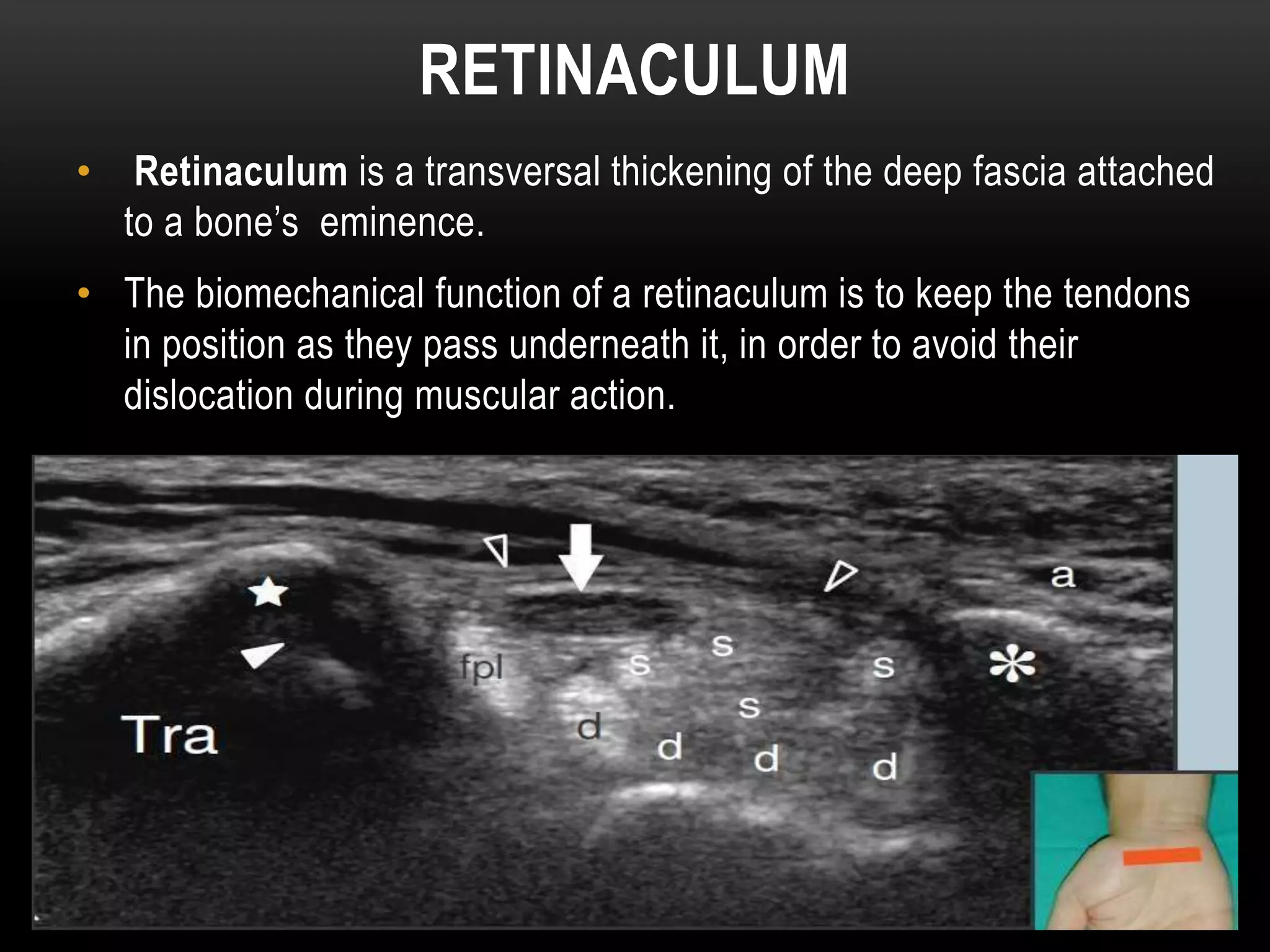 Musculoskeletal Ultrasound - Basic | PPTX