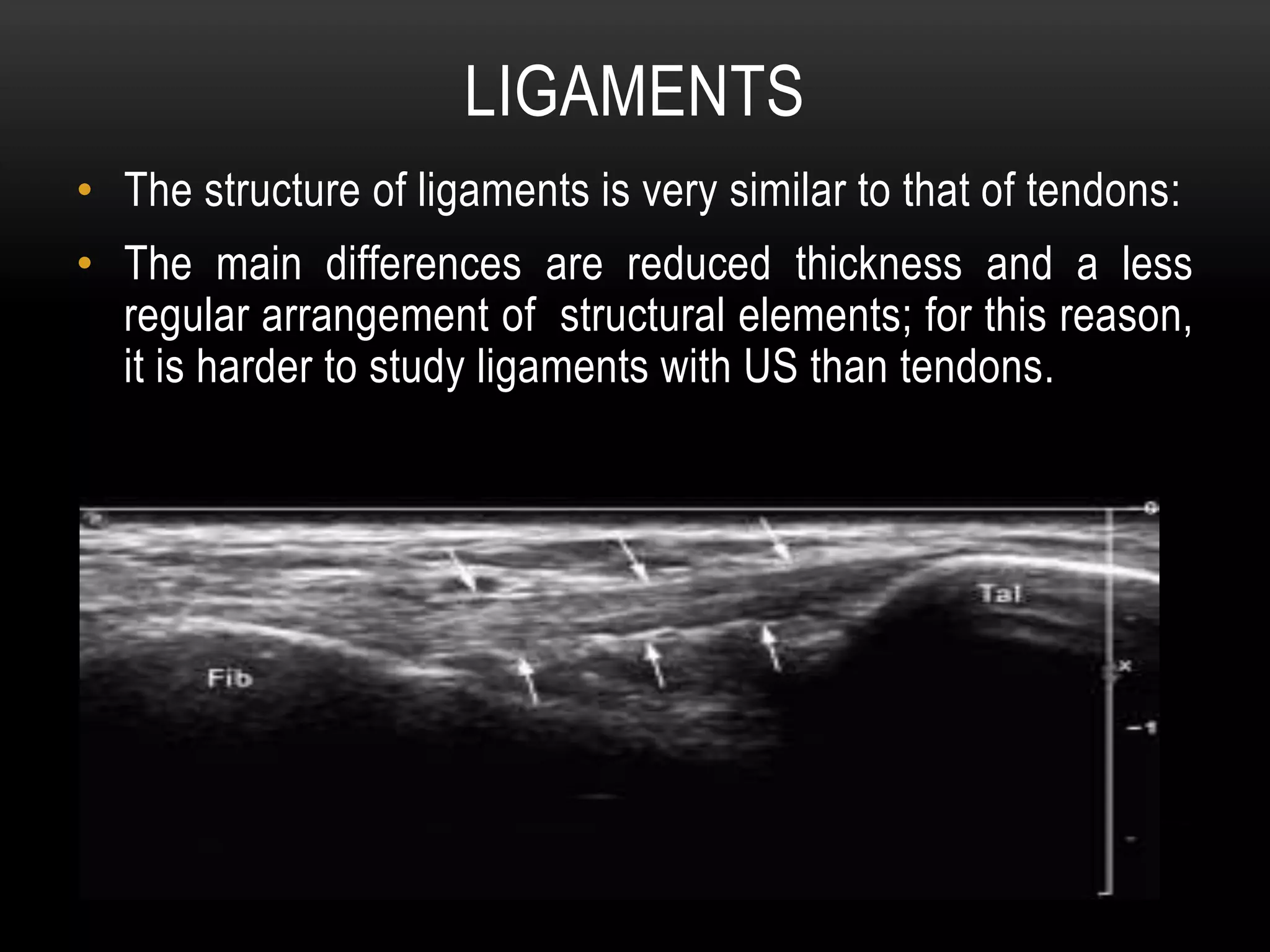 Musculoskeletal Ultrasound - Basic | PPTX