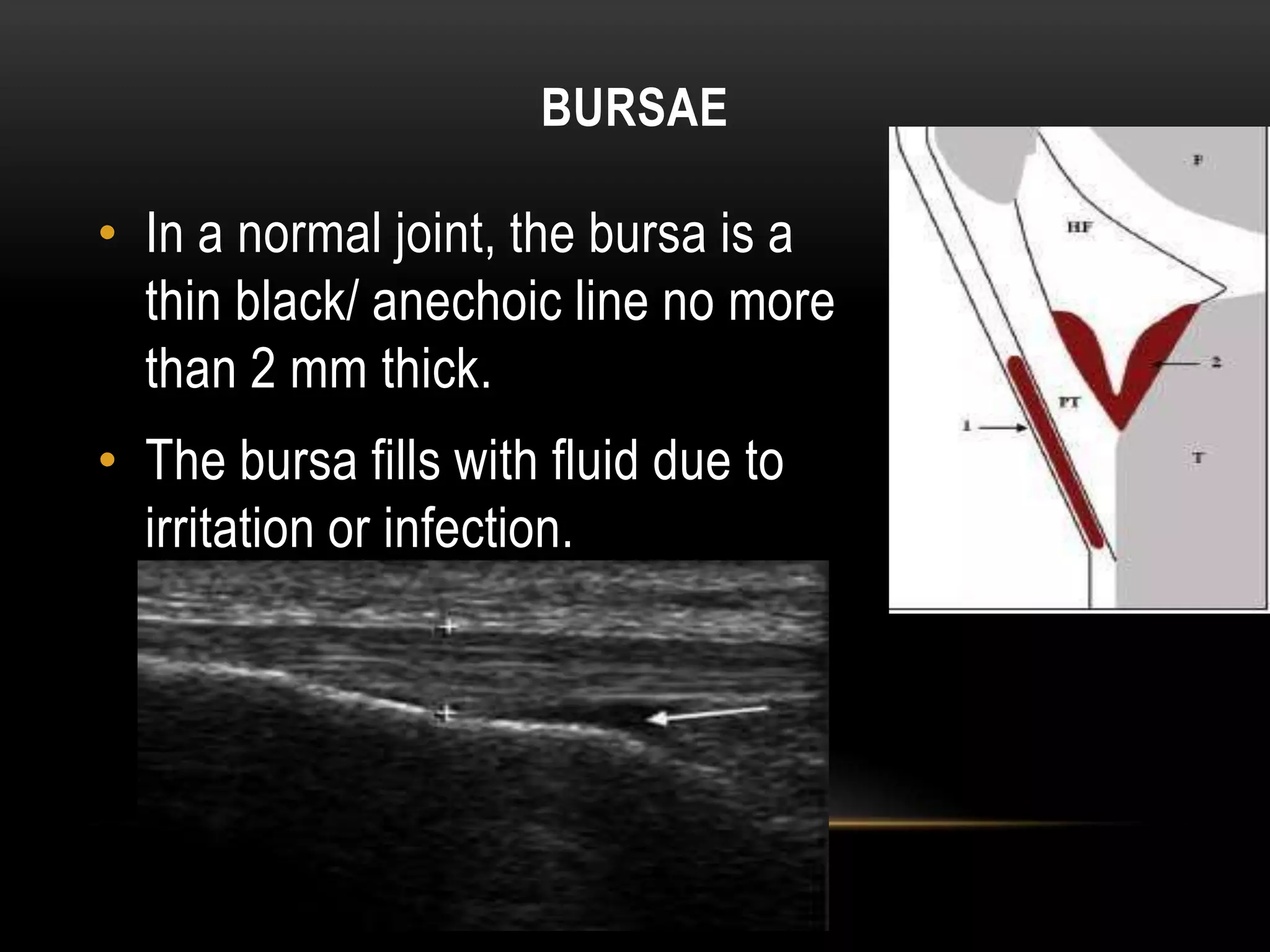 Musculoskeletal Ultrasound - Basic | PPTX