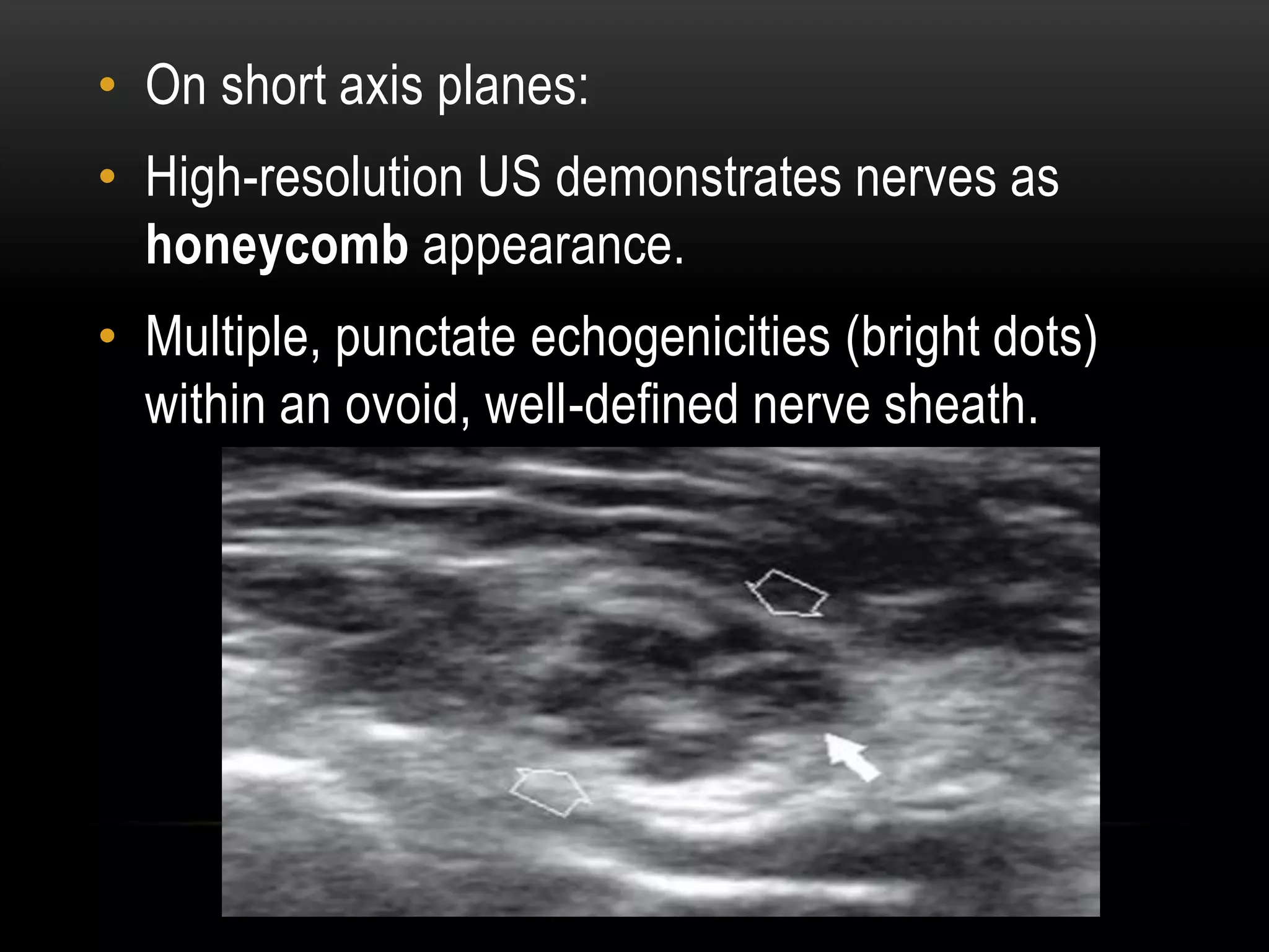 Musculoskeletal Ultrasound - Basic | PPTX
