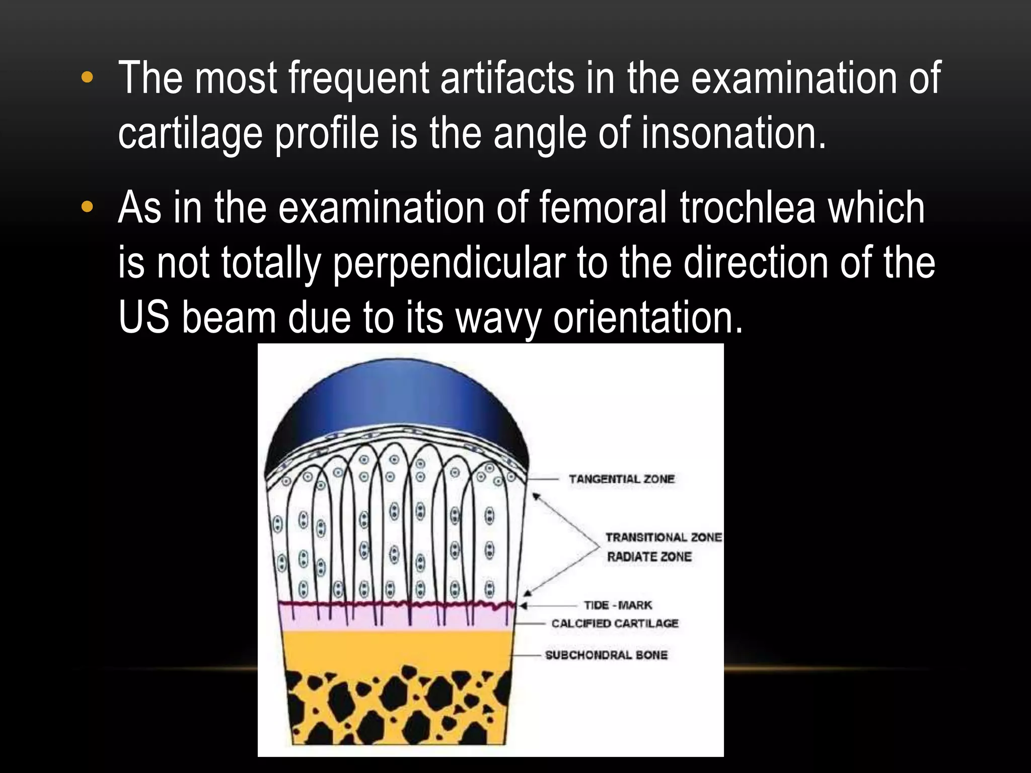 Musculoskeletal Ultrasound - Basic | PPTX