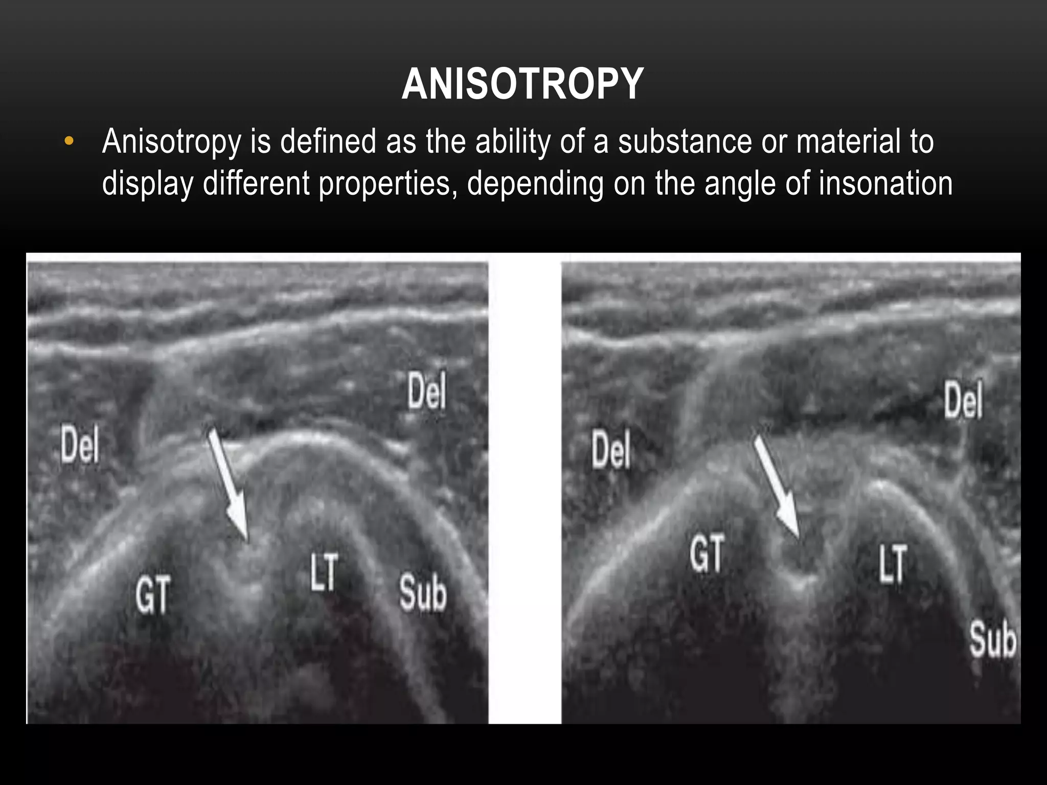 Musculoskeletal Ultrasound - Basic | PPTX