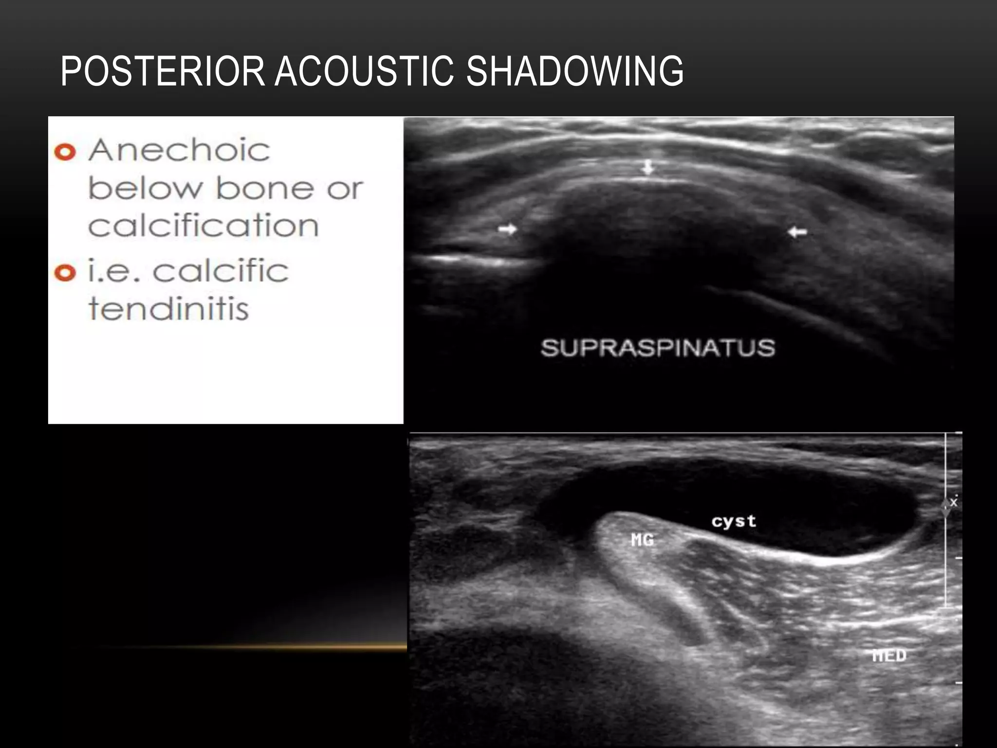Musculoskeletal Ultrasound - Basic | PPTX