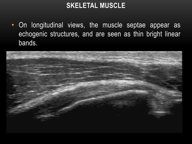 Musculoskeletal Ultrasound - Basic | PPT