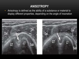Musculoskeletal Ultrasound - Basic | PPTX