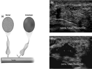 Musculoskeletal Ultrasound - Basic | PPTX
