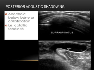 Musculoskeletal Ultrasound - Basic | PPTX