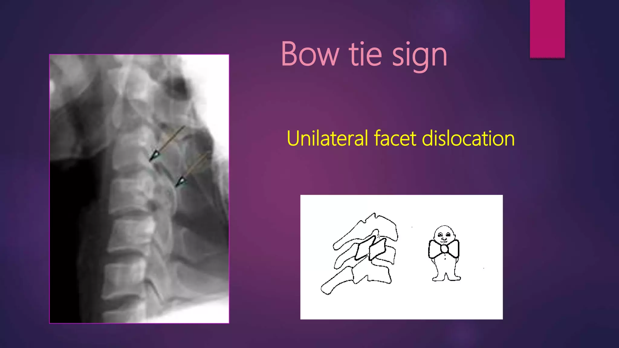 Msk signs edited | PPTX