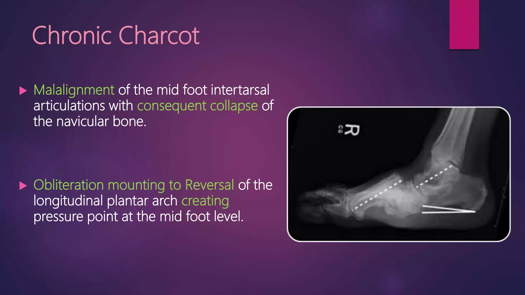 Msk signs edited | PPTX