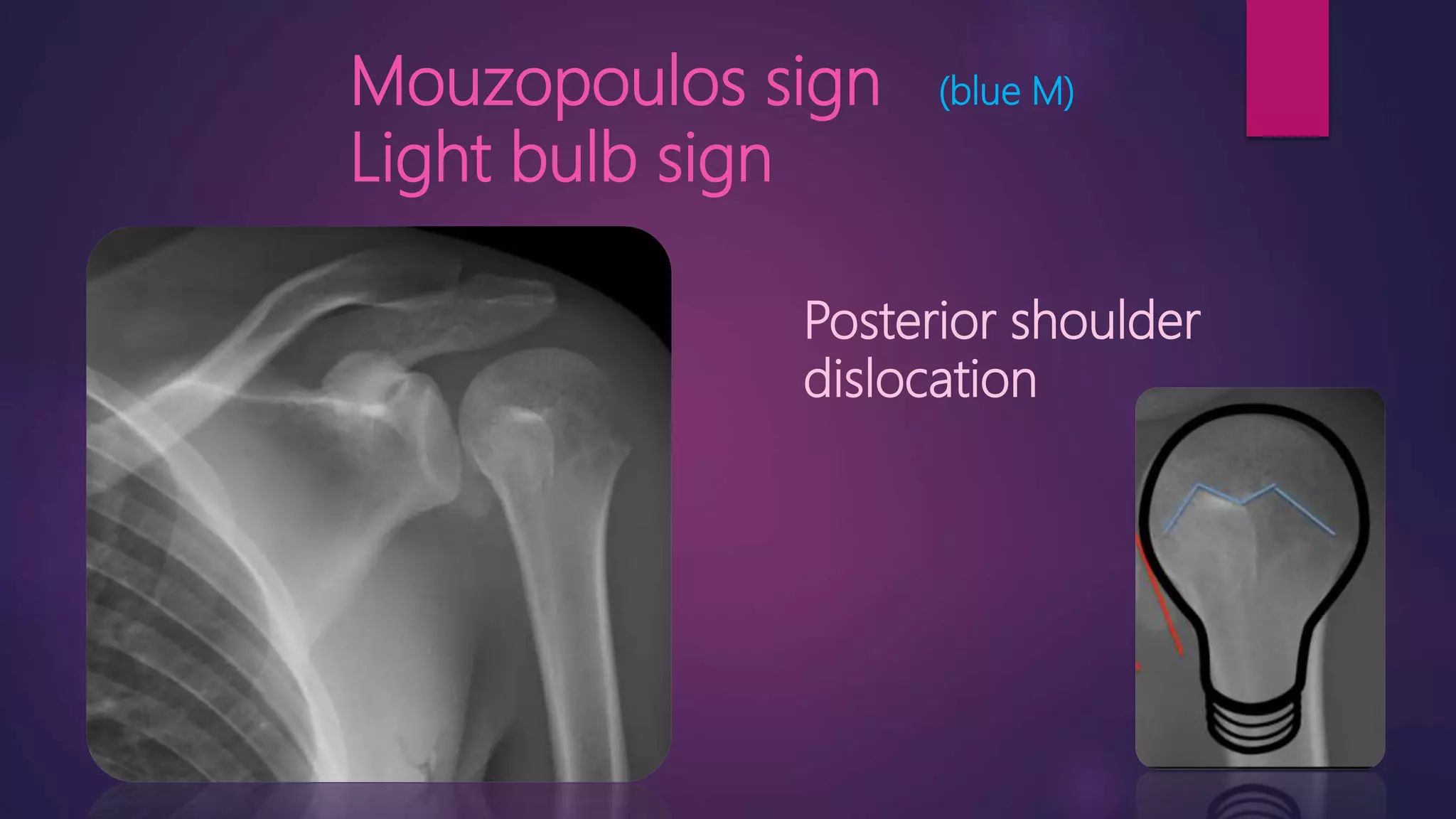 Msk signs edited | PPTX