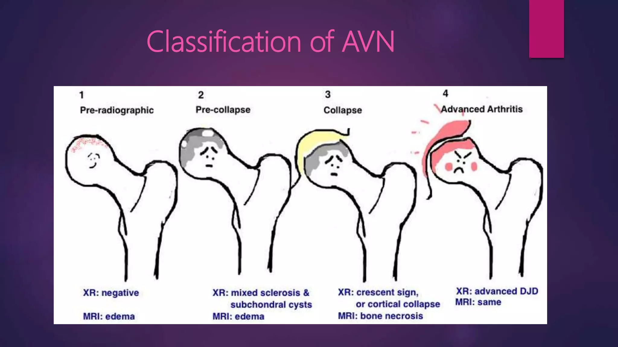Msk signs edited | PPTX