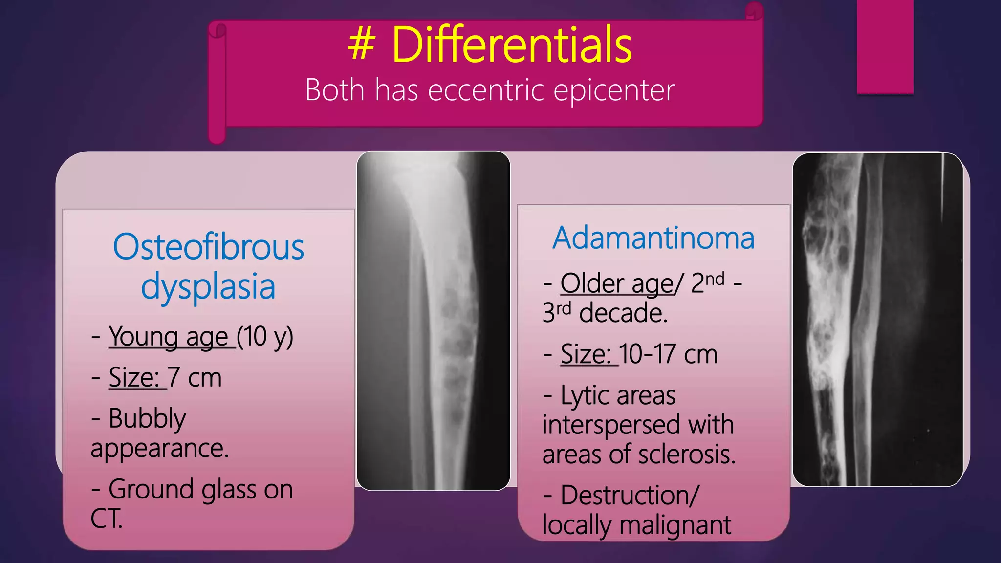 Msk signs edited | PPTX