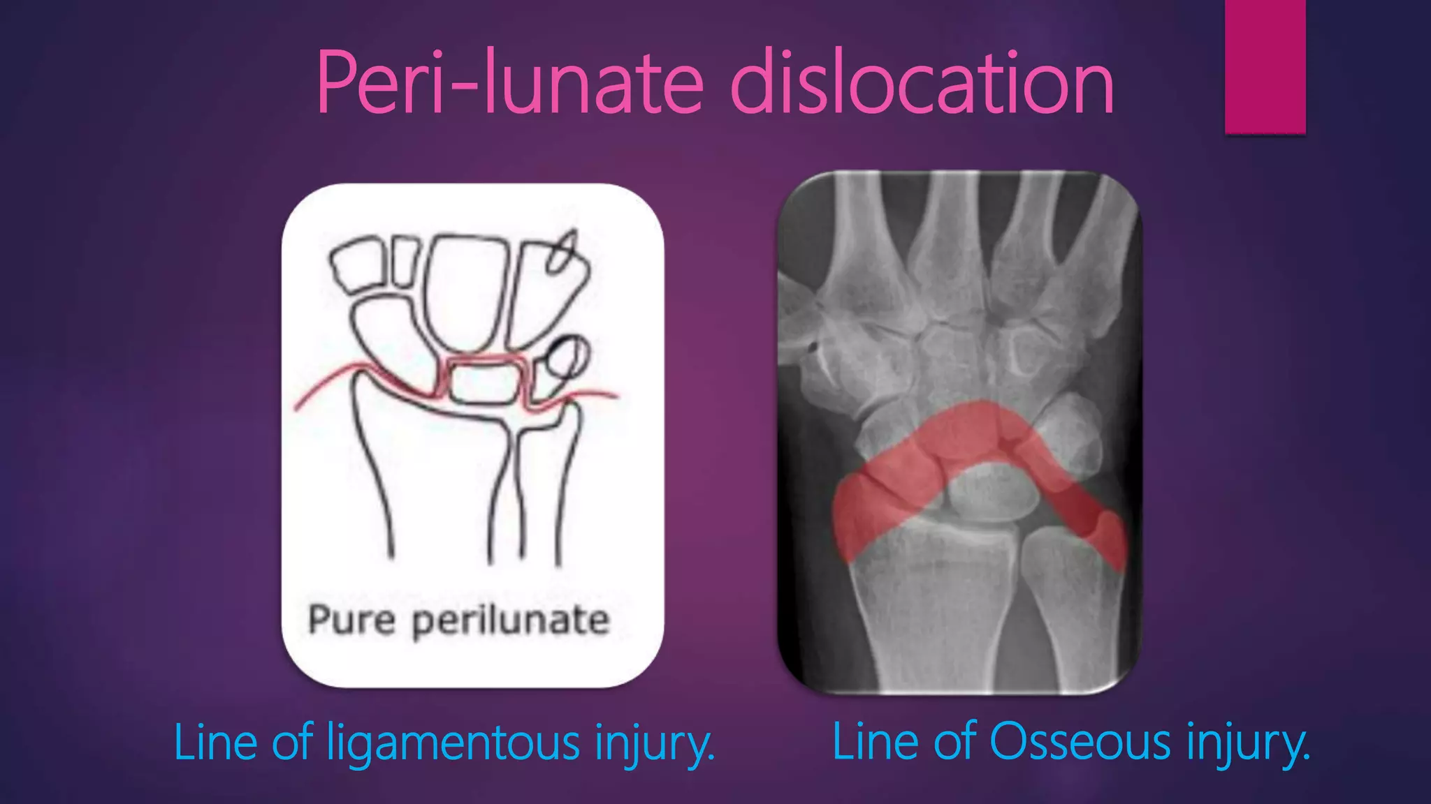 Msk signs edited | PPTX