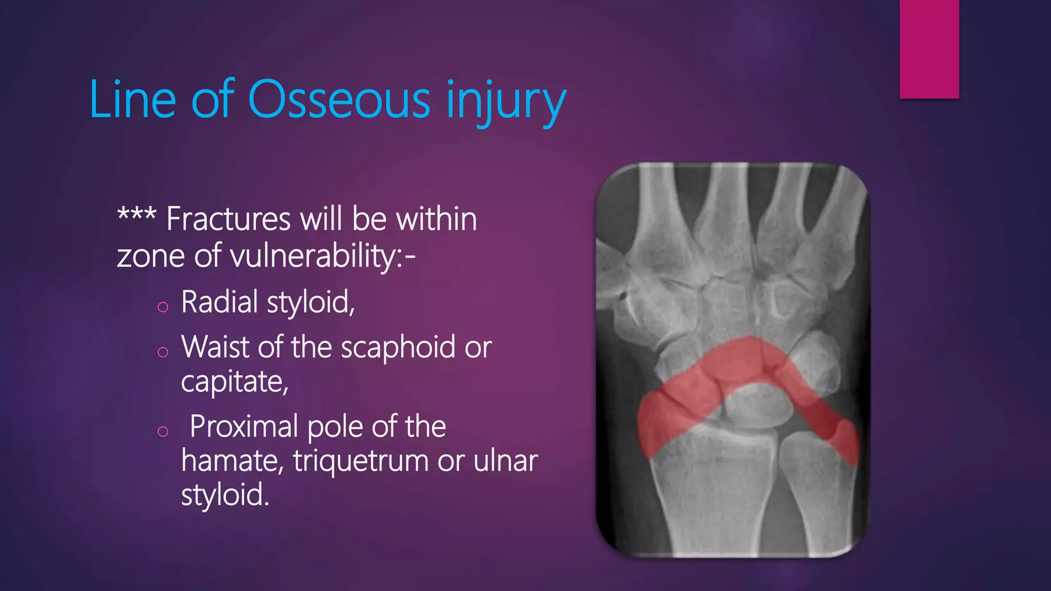 Msk signs edited | PPTX